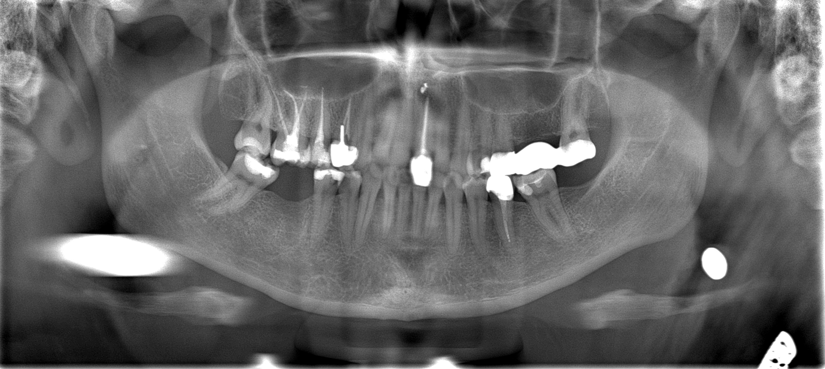 Rätselbild zum Wochenende | WURZELSPITZE